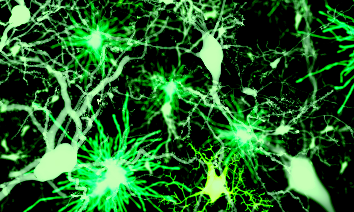 The Science Behind Better Visualizing Brain Function